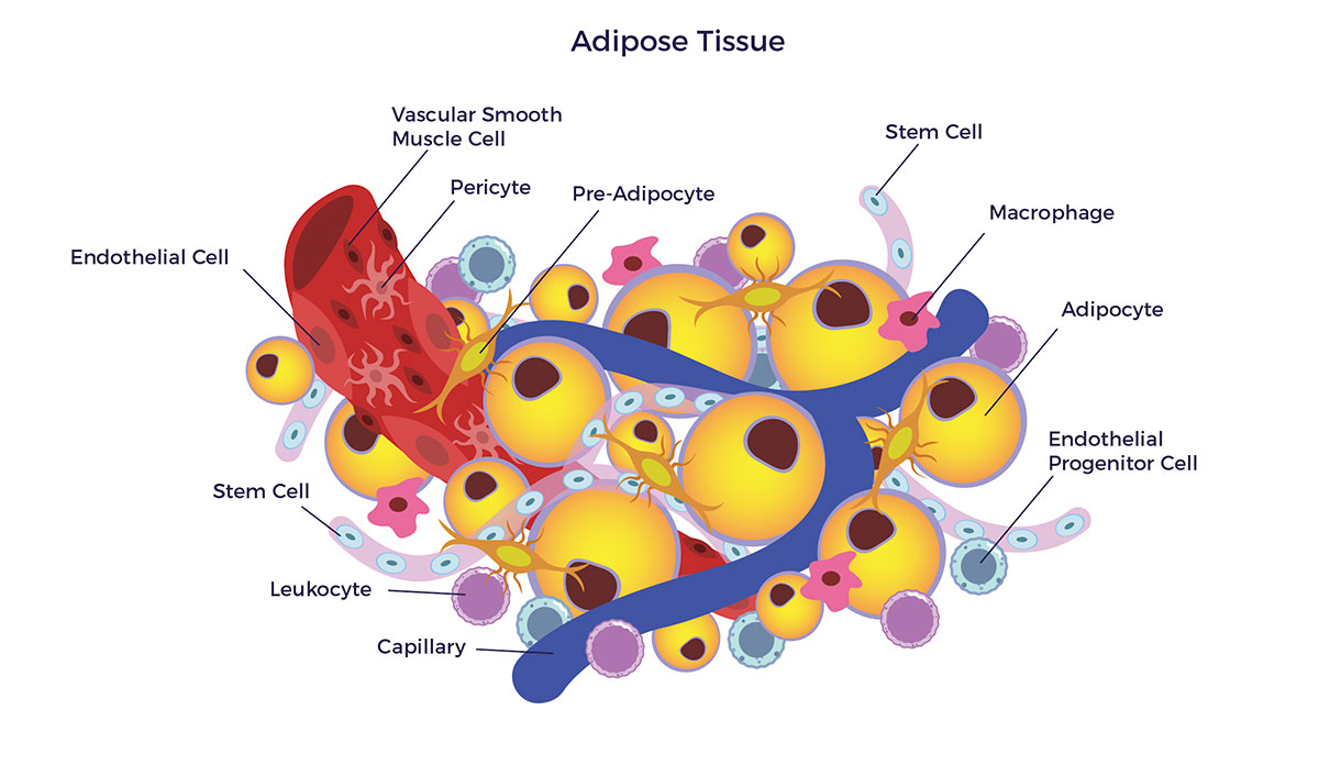 Why Adipose Tissue AMBROSE Cell Therapy